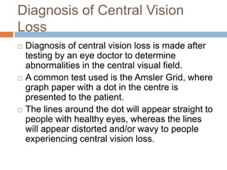 Central and Peripheral Vision & their Diseases | PPTX