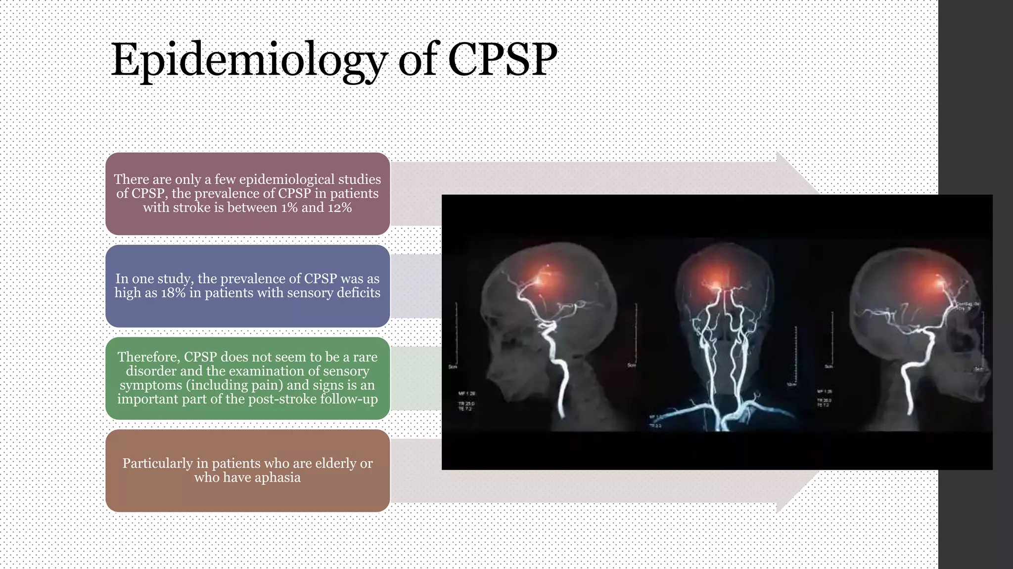 Central post stroke pain (cpsp) | PPTX