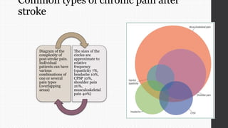 Central post stroke pain (cpsp) | PPTX