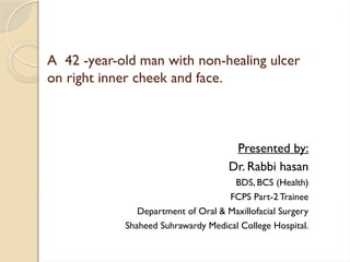 Central Presentation on SCC of oral mucosa (1).pptx