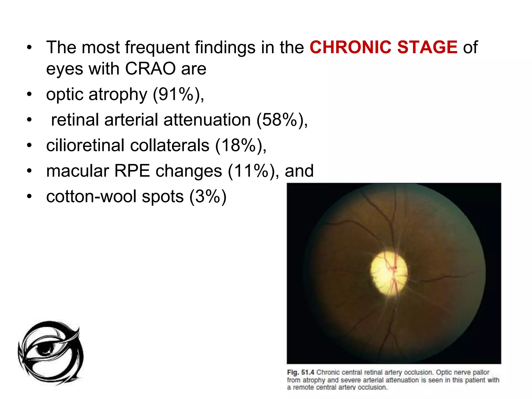 Central retinal artery occlusion | PPTX