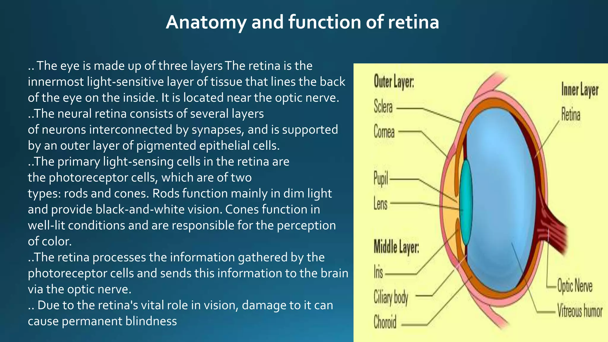 Central retinal vein occlusion CRVO | PPTX