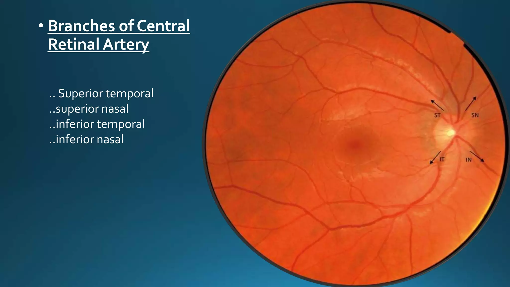 Central retinal vein occlusion CRVO | PPTX