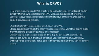 Central retinal vein occlusion CRVO | PPTX