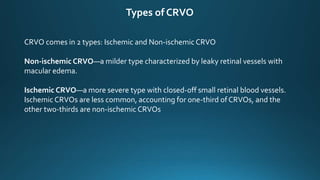 Central retinal vein occlusion CRVO | PPTX