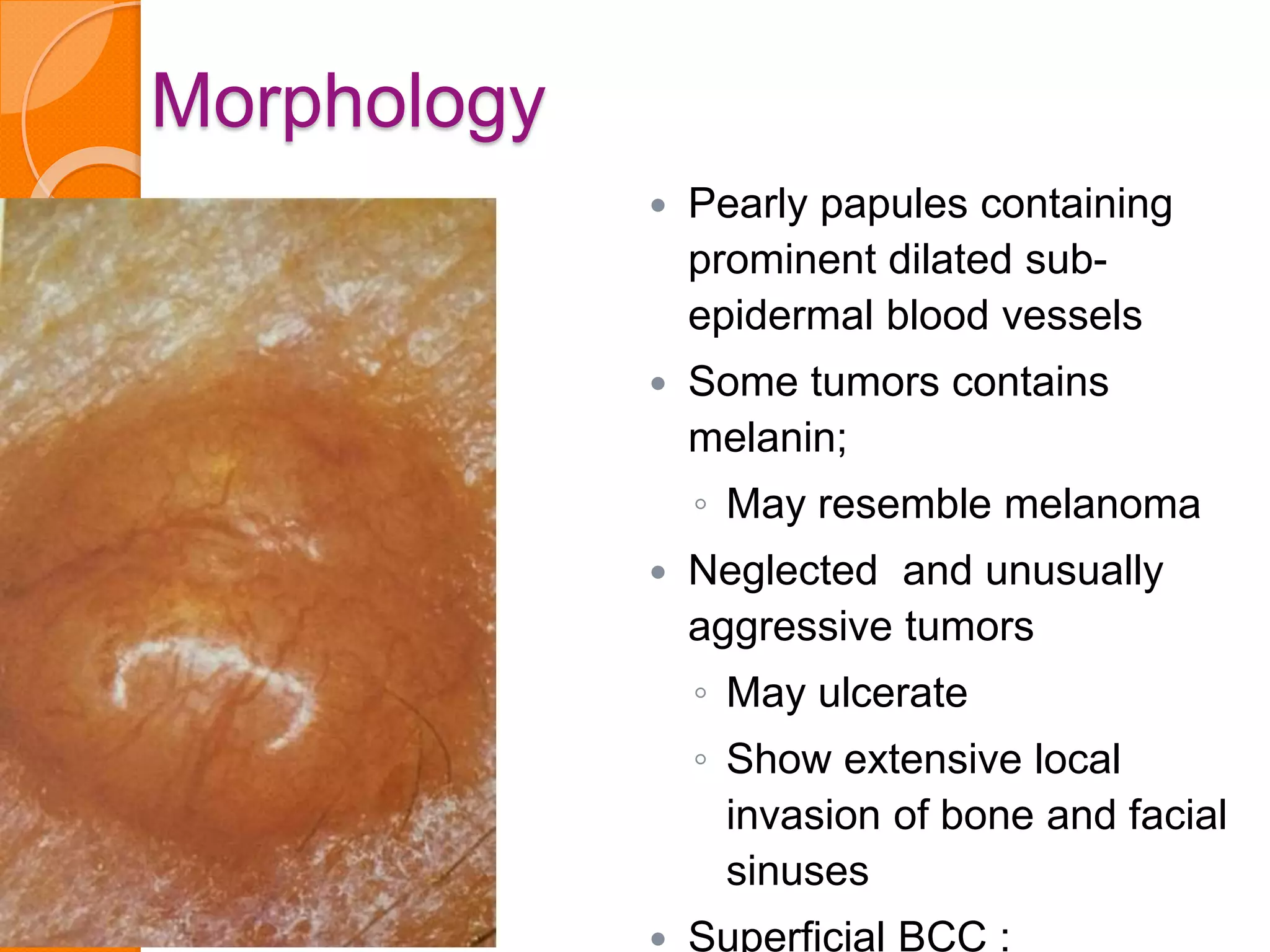 pathology of skin malignancy | PPTX