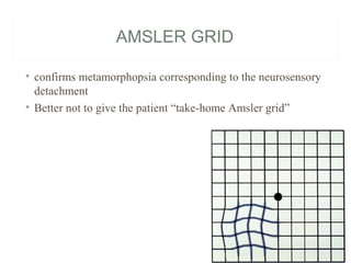Central serous chorioretinopathy | PPT