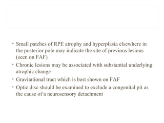 Central serous chorioretinopathy | PPT