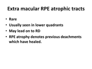 Central serous chorioretinopathy | PPTX