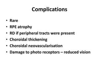 Central serous chorioretinopathy | PPTX