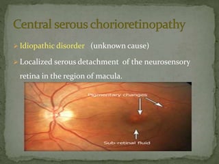 Central serous retinopathy | PPTX | Eye and Vision Conditions ...