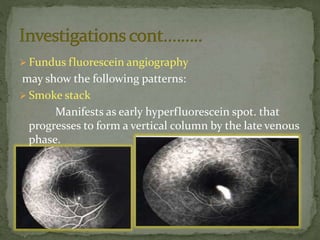 Fundus Fluorescein Angiography Central Serous Retinopathy