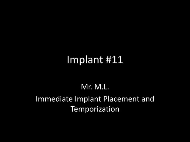 Immediate Implant Placement and Temporization | PDF