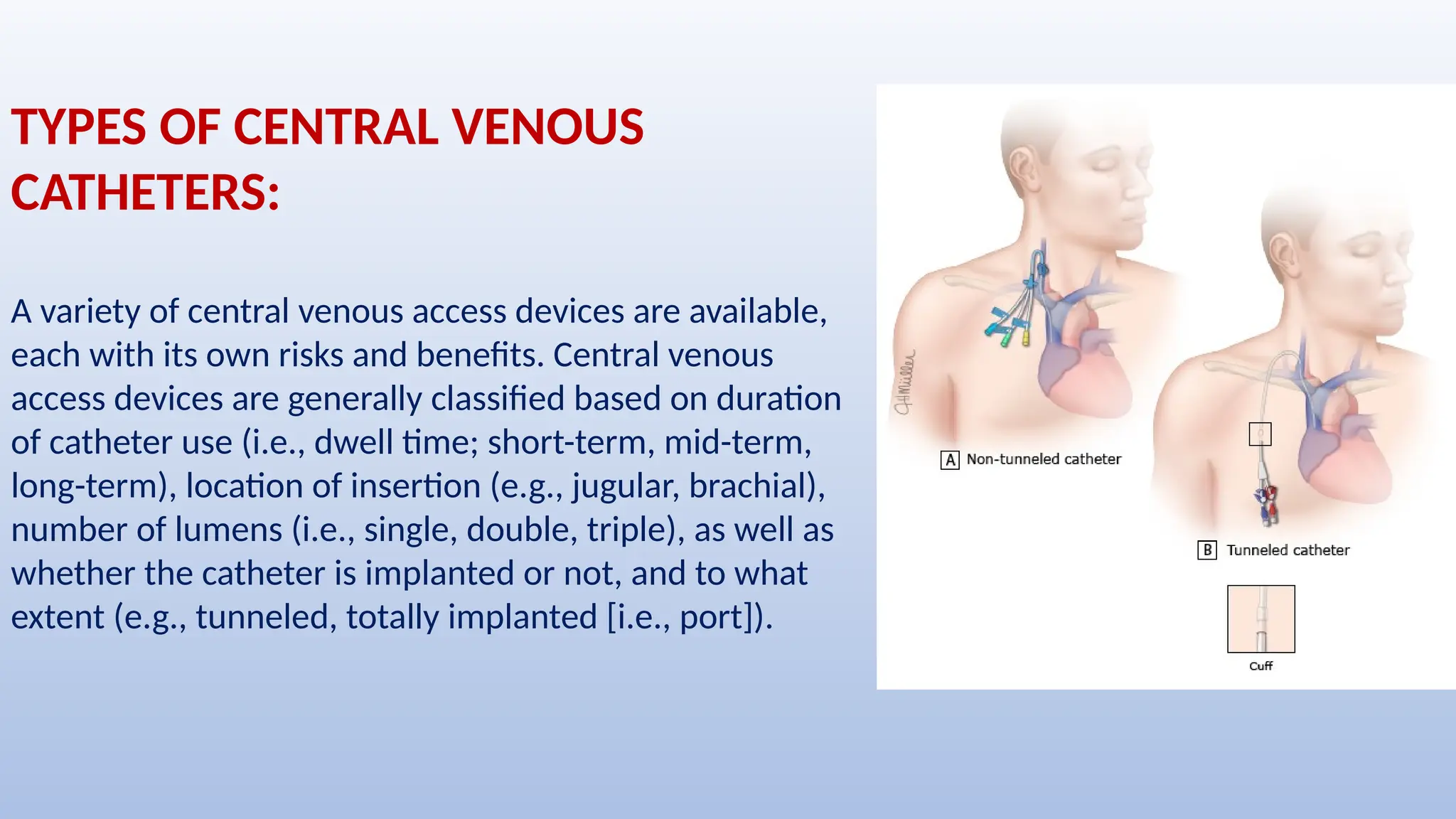 Central venous access devices all you need to know | PPTX
