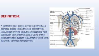 Central venous access devices all you need to know | PPTX