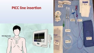 Central venous access devices all you need to know | PPTX