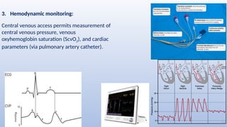 Central venous access devices all you need to know | PPTX