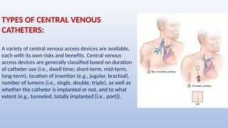 Central venous access devices all you need to know | PPTX
