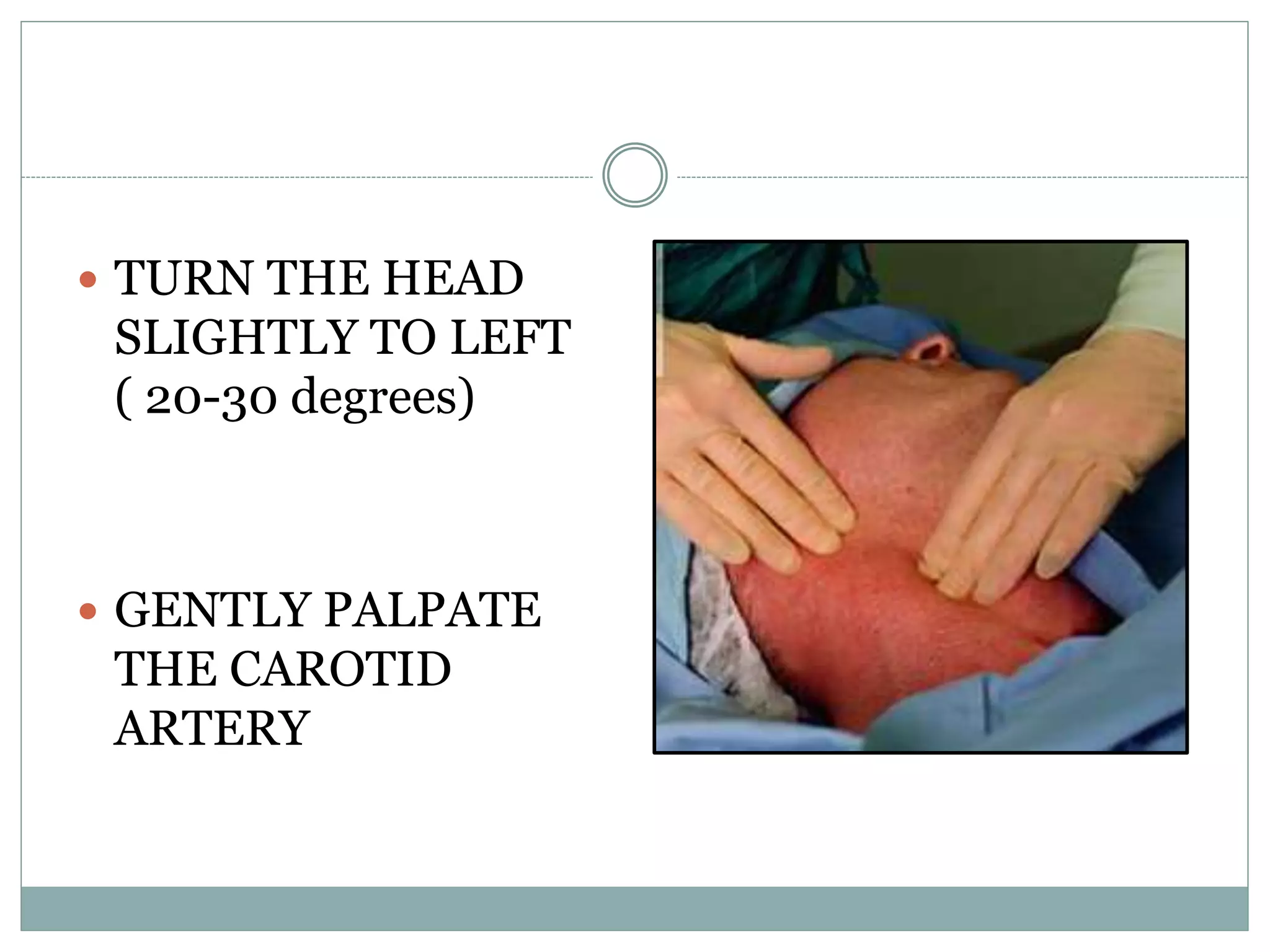 Central venous cannulation | PPTX