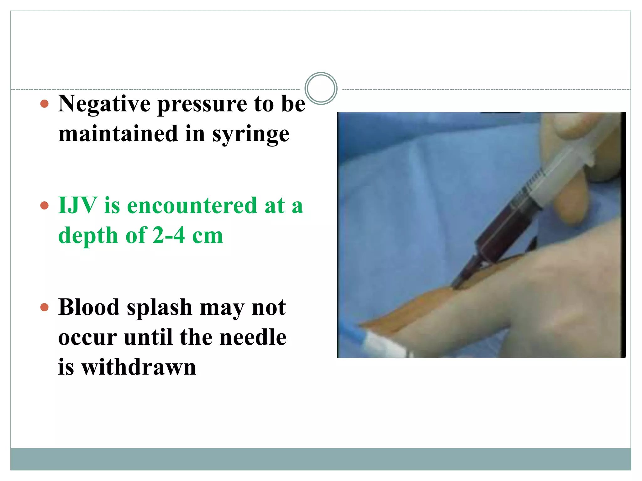 Central venous cannulation | PPTX