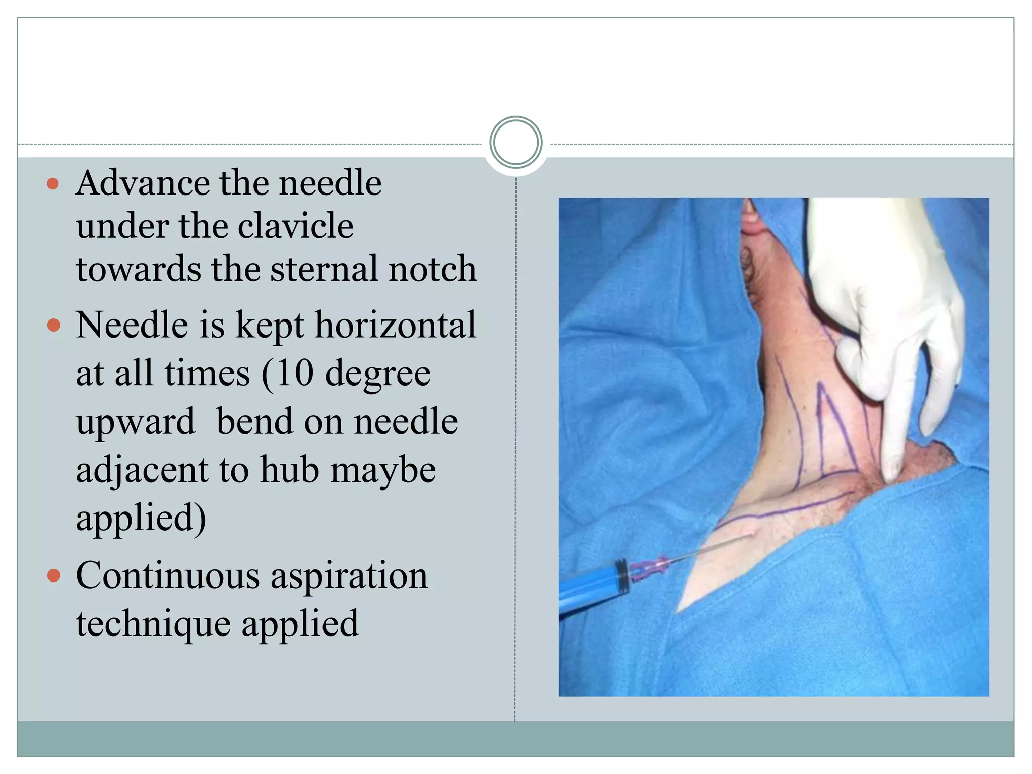 Central venous cannulation | PPTX