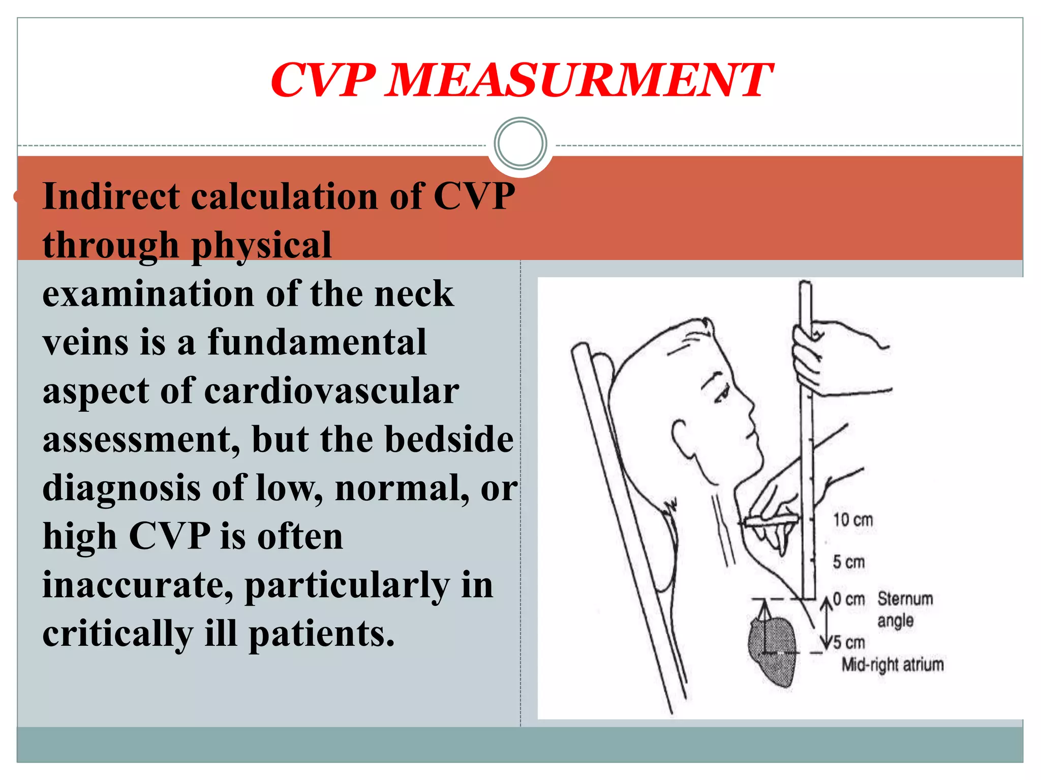Central venous cannulation | PPTX
