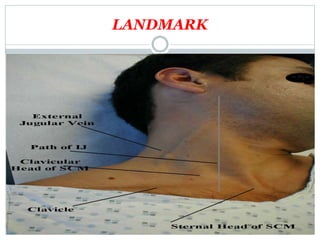 Landmark-Based Peripheral Intravenous Catheters, 46% OFF