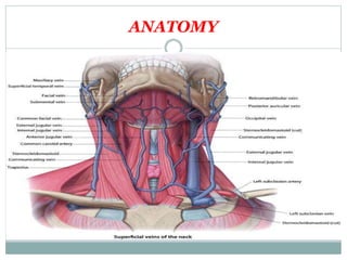 External Jugular Vein Cannulation