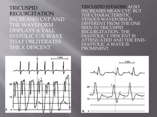 CENTRAL VENOUS CATHETER | PPTX