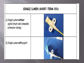 CENTRAL VENOUS CATHETER | PPTX