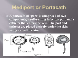 CENTRAL VENOUS CATHETER | PPTX