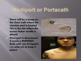 CENTRAL VENOUS CATHETER | PPTX