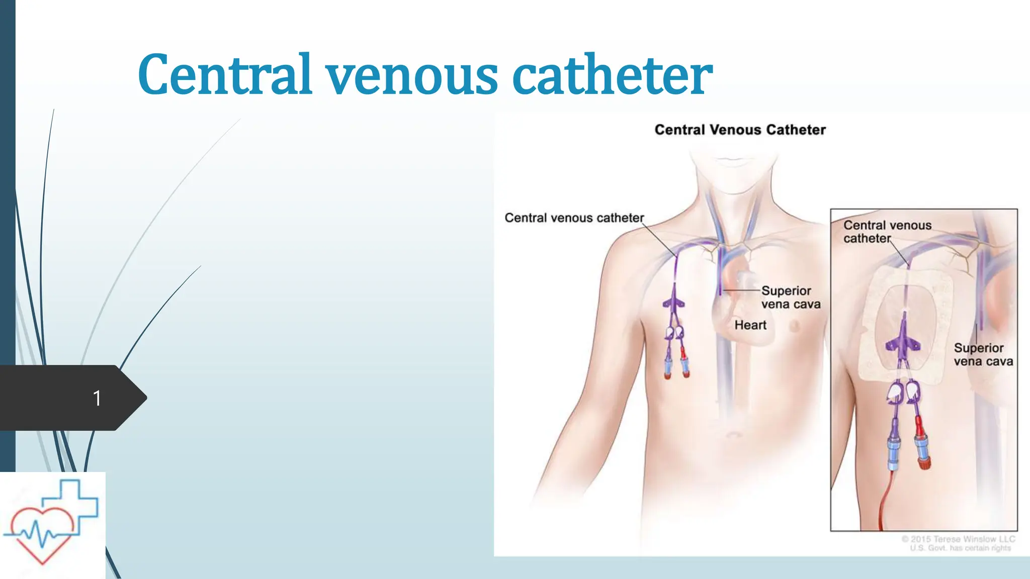 Central venous catheter Introductio.pptx