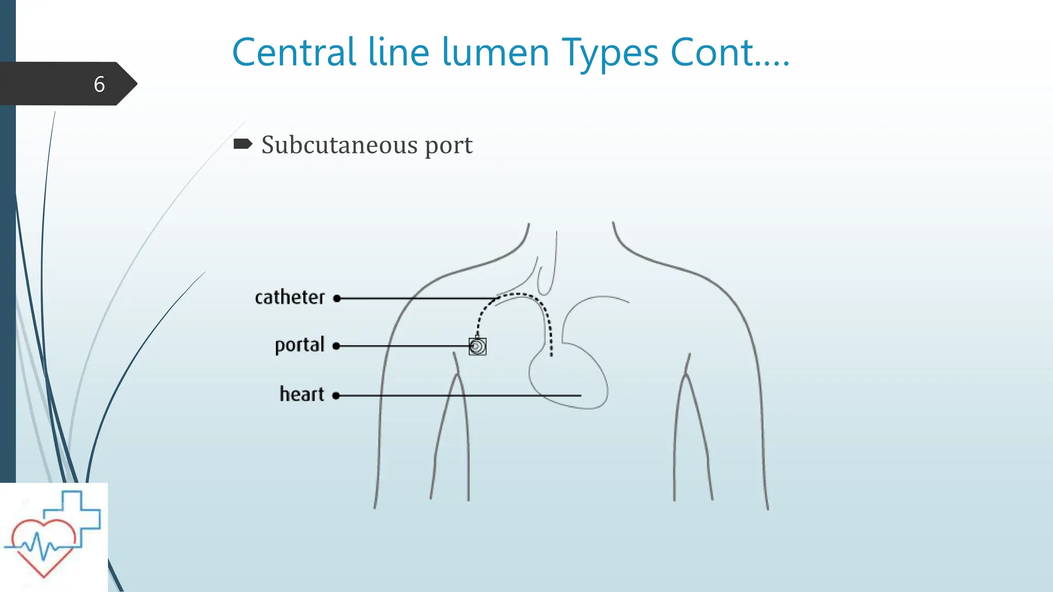 Central venous catheter Introductio.pptx