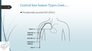 Central venous catheter Introductio.pptx