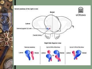 Central venous catheterisation | PPT