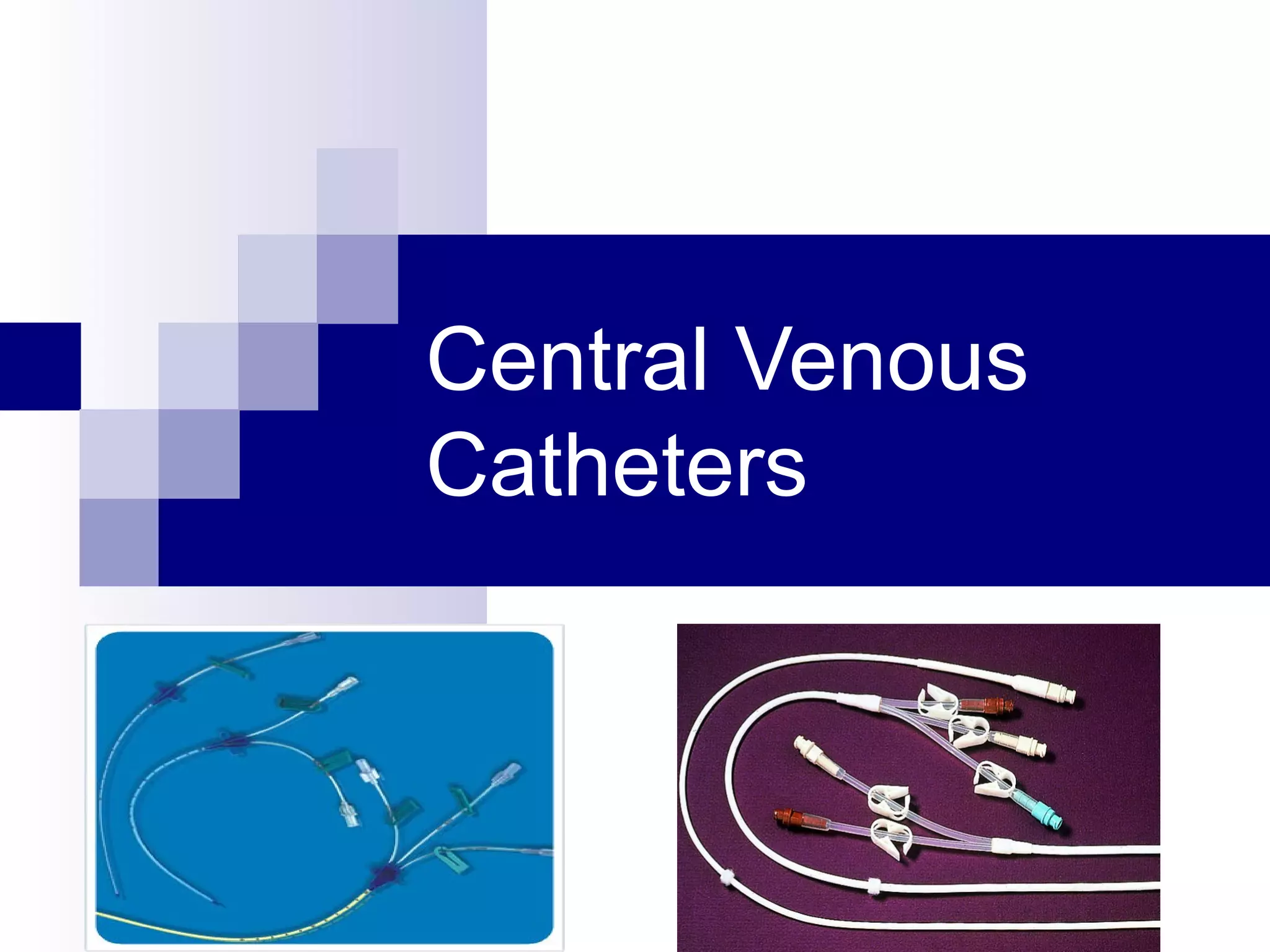 Central venous catheterization | PPT