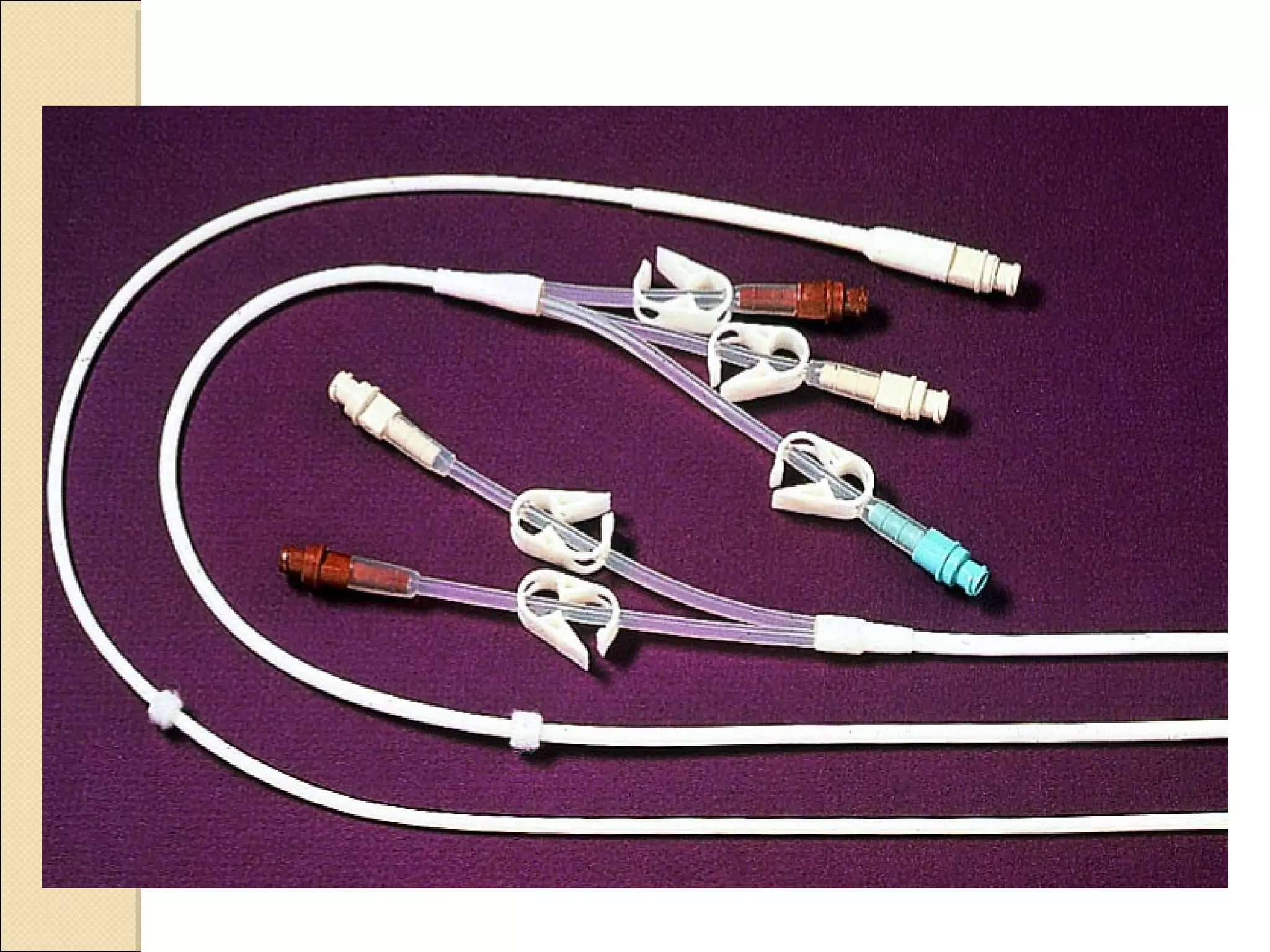 Central venous catheterization | PPT