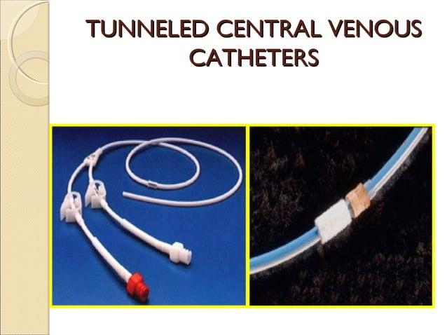 Central venous catheterization | PPT