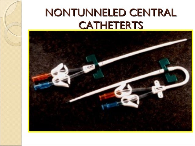 Central venous catheterization