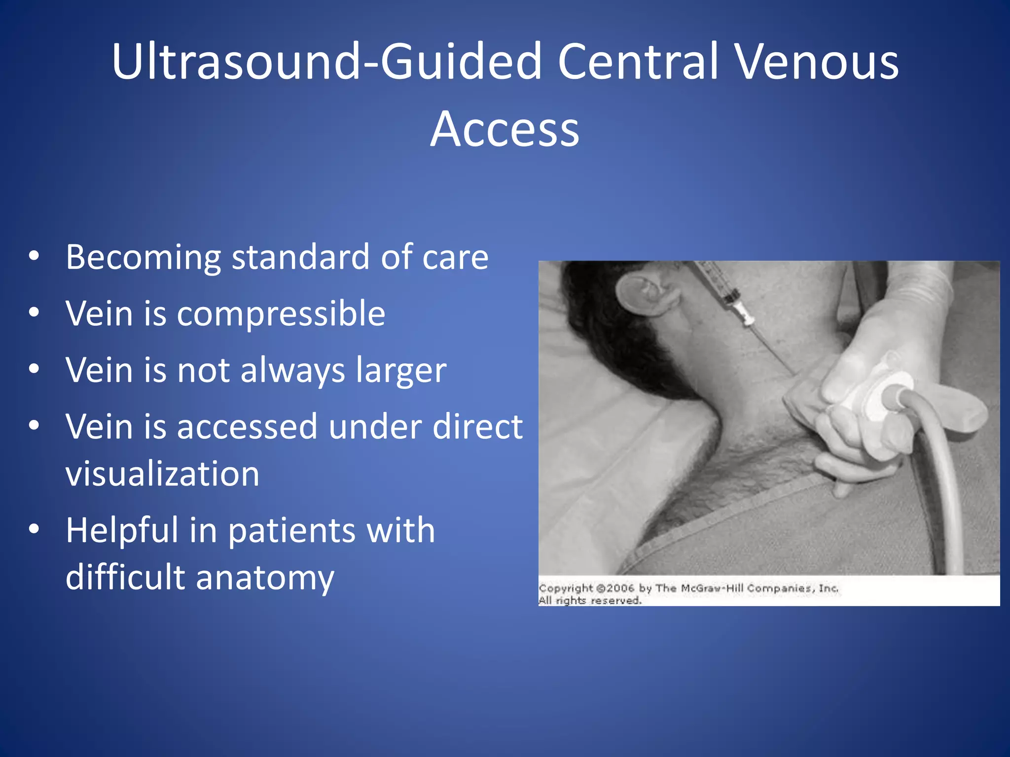 Central venous catheterization | PPTX