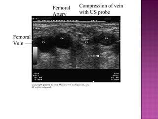 Central venous catheterization | PPT