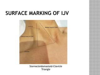 CENTRAL VENOUS CATHETERIZATION FOR CARDIAC | PPTX
