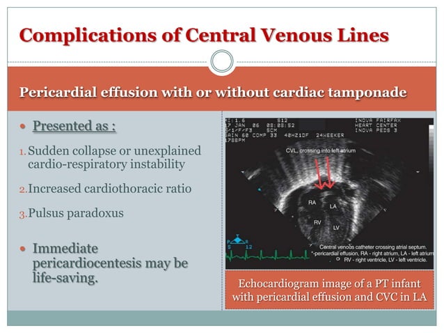 Precautions for Central Venous Catheters in Neonates | PPTX
