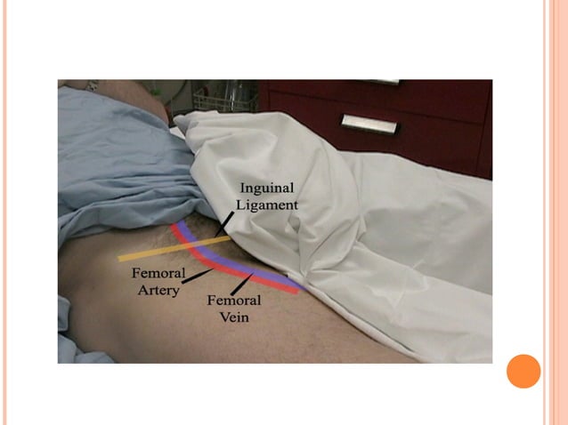 Central venous lines and their problems | PPT
