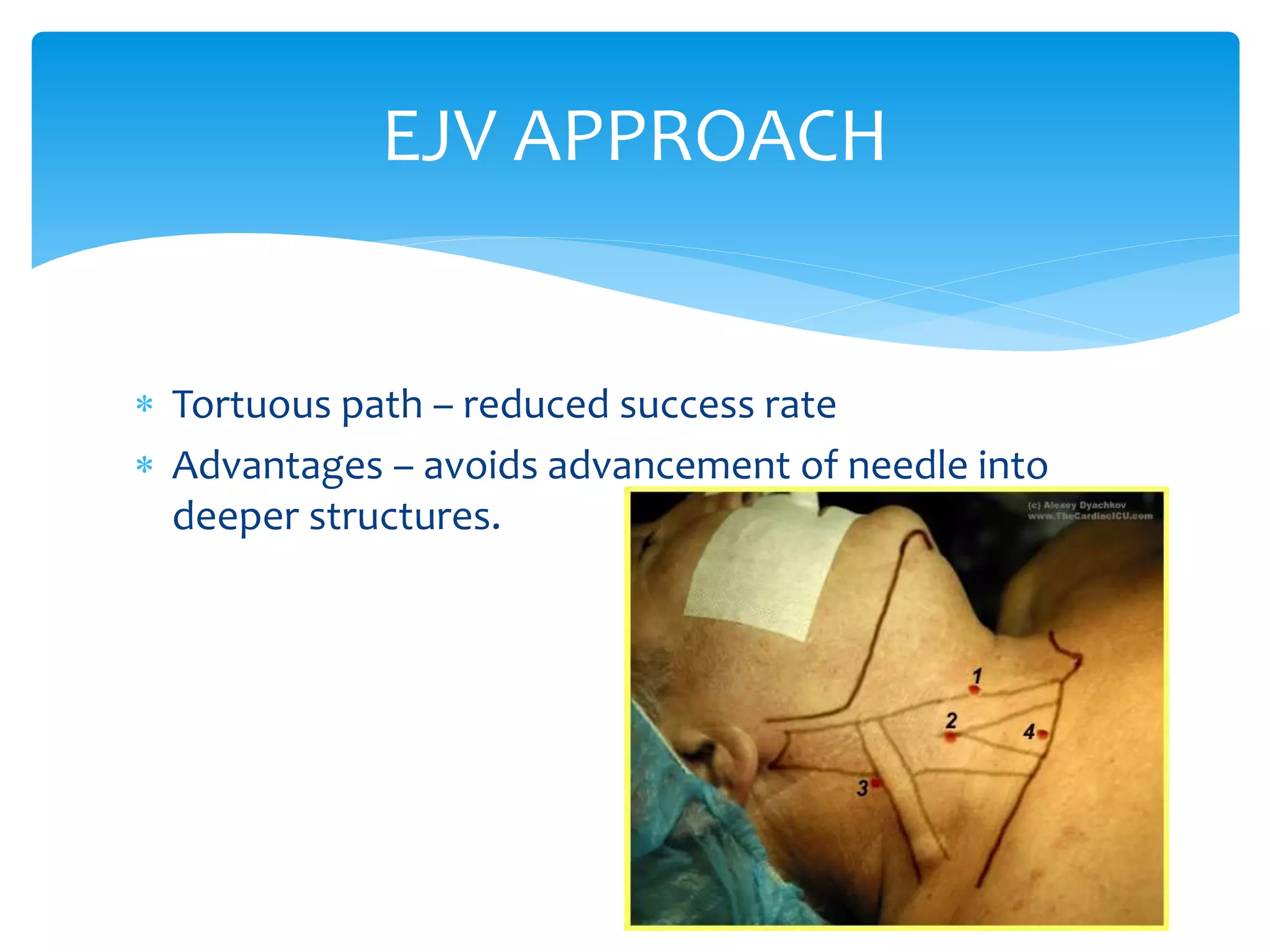 Central venous pressure | PPTX