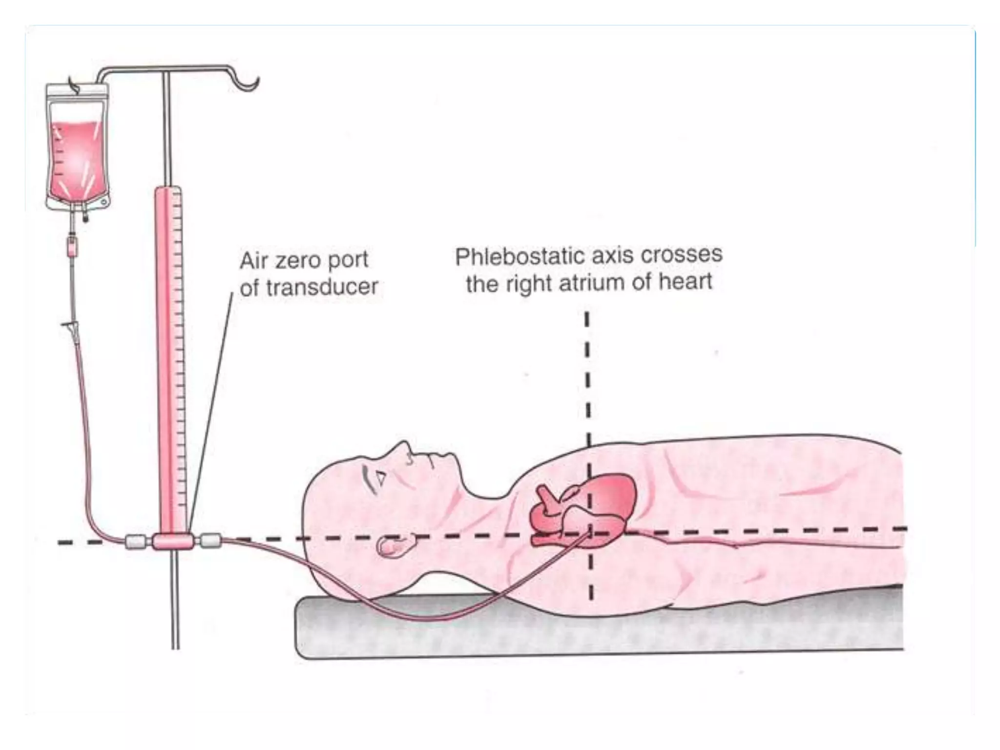 Central venous pressure | PPTX
