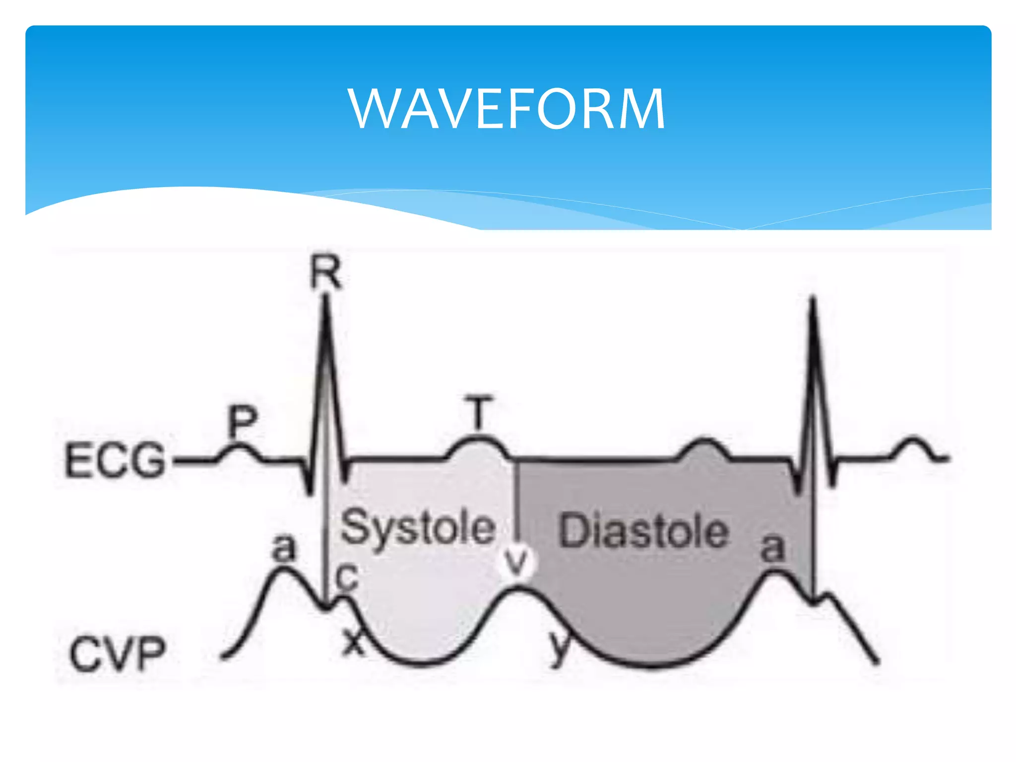 Central venous pressure | PPTX