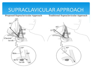 Central venous pressure | PPTX