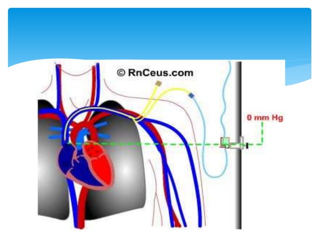 Central venous pressure | PPTX